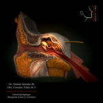 Cadena Osicular » ORL FACE