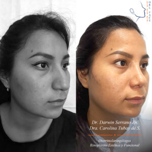 ORL FACE. Dr. Darwin Serrano Zh. Dra. Carolina Tubay de Serrano. Otorrinos