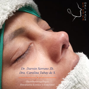 ORL FACE. Dr. Darwin Serrano Zh. Dra. Carolina Tubay de Serrano. Otorrinos